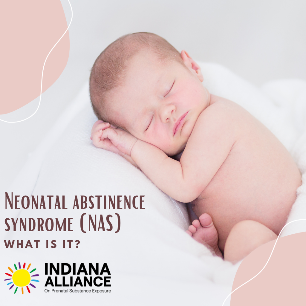 Neonatal abstinence syndrome (NAS) - Indiana Alliance on Prenatal ...